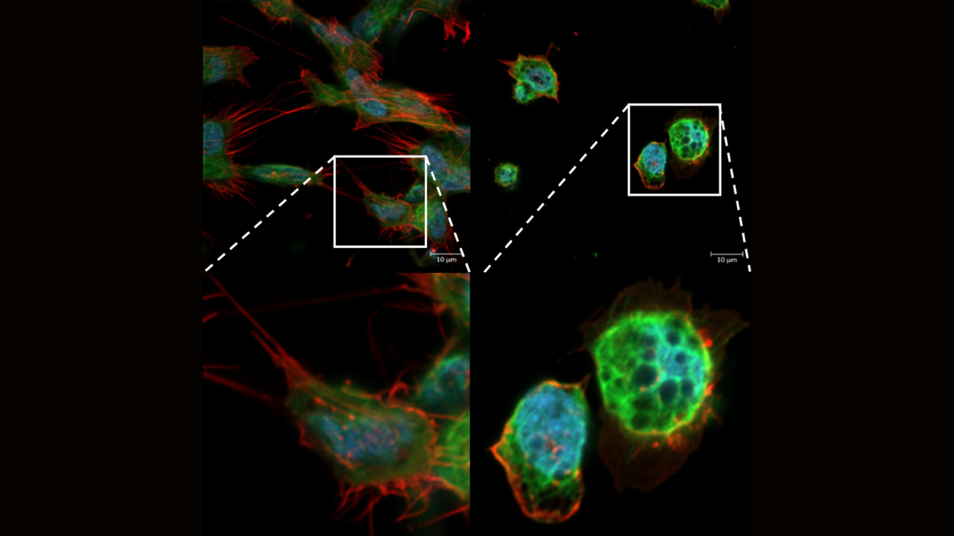 Vall d’Hebron estudia la reprogramación epigenética para evitar la ...