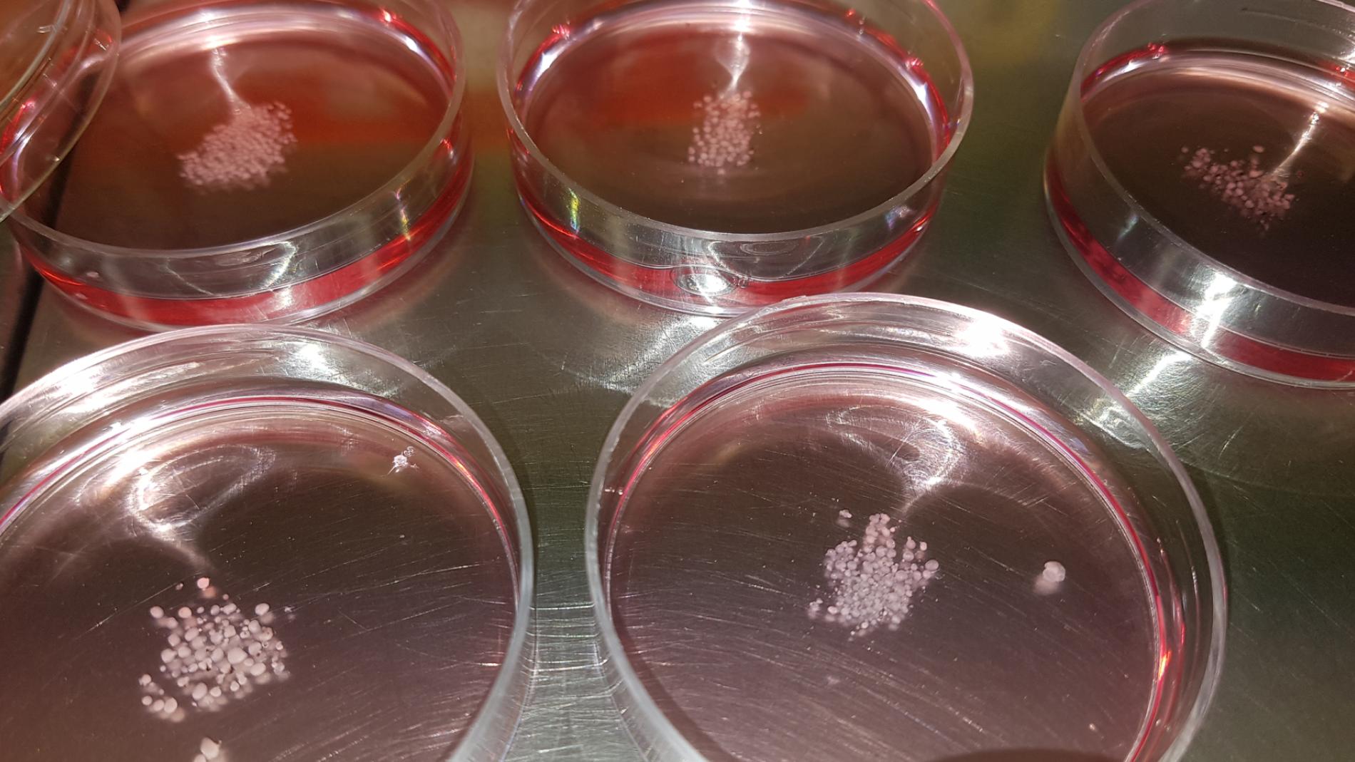 Vall d'Hebron highlights the importance of organoids in research and ...